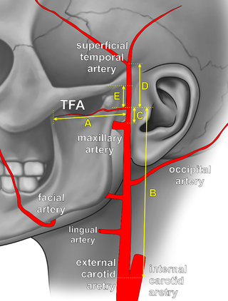 external carotid artery tree – Cosmedic Training Academy