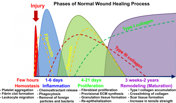 Graphical-representation-of-four-phases-of-normal-wound-healing-process ...